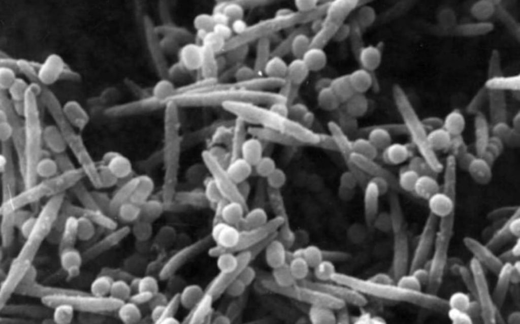 Know your dog’s gut bacteria: Fusobacterium – Happy One Dog